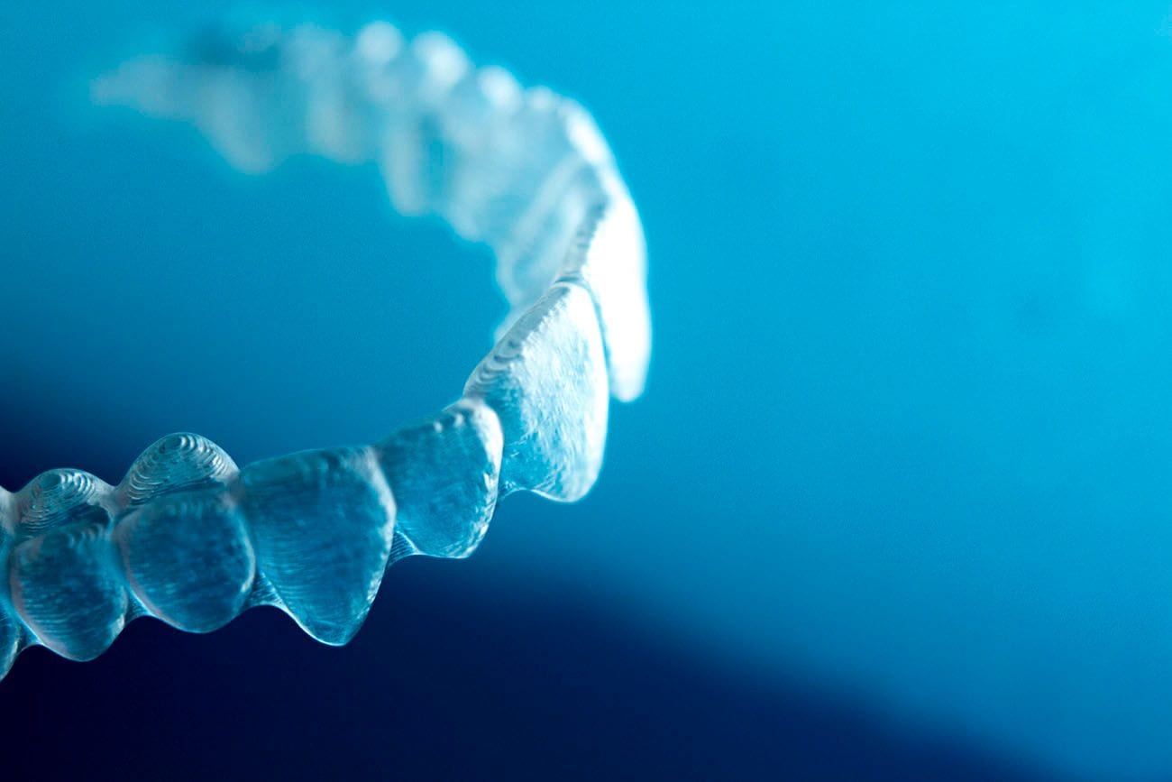 The Benefits of Invisalign | Cosmetic Dentist in Washington DC